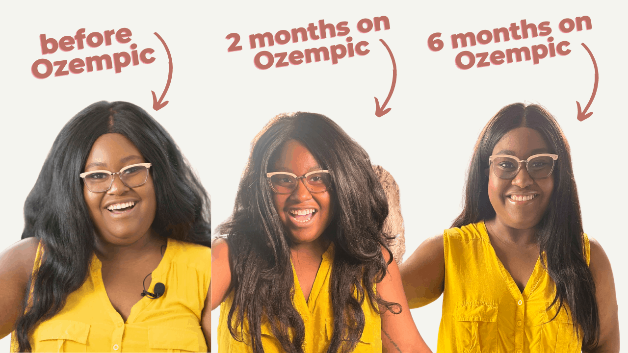 Top 7 Does Ozempic Need To Be Refrigerated 2022